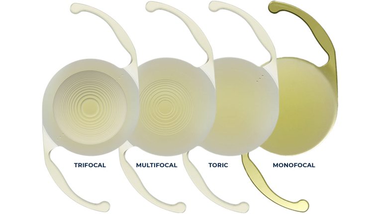 INTRAOCULAR LENS OPTIONS - Cataract & Refractive Surgeon Singapore | Dr ...